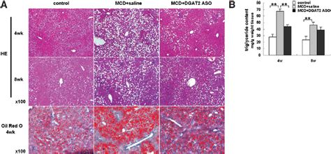 liver histology and triglyceride content of db db mice a hematoxylin