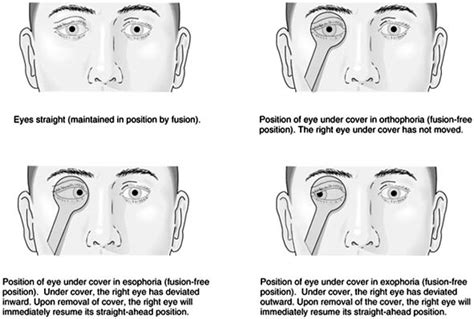 Cover Test Procedure