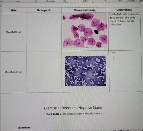 Solved Bacteria Morphology And Staining Techniques Slide