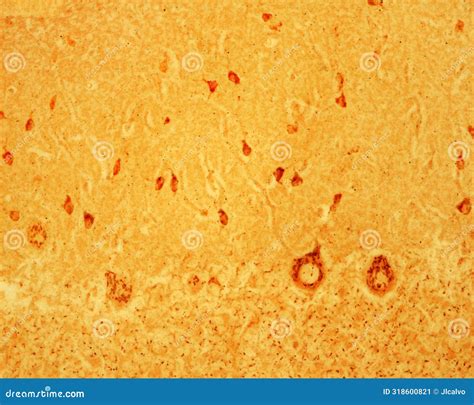 Cerebellum Purkinje Neurons Golgi Apparatus Stock Image Image Of Micrograph Neuroscience