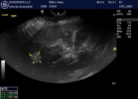 Reactive Mesenteric Fat Members