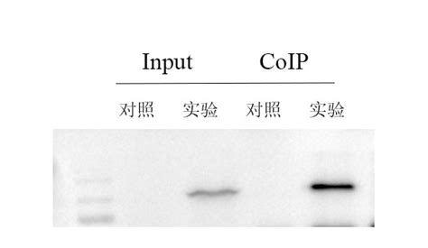 技术服务 Rna 结合蛋白免疫共沉淀rip