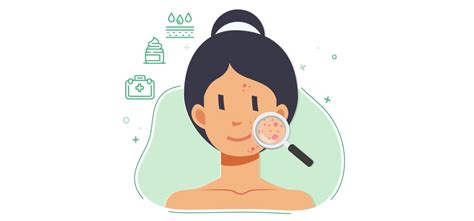 Acne Causes And Treatments Healthera Order Nhs Prescriptions And Medicines Online