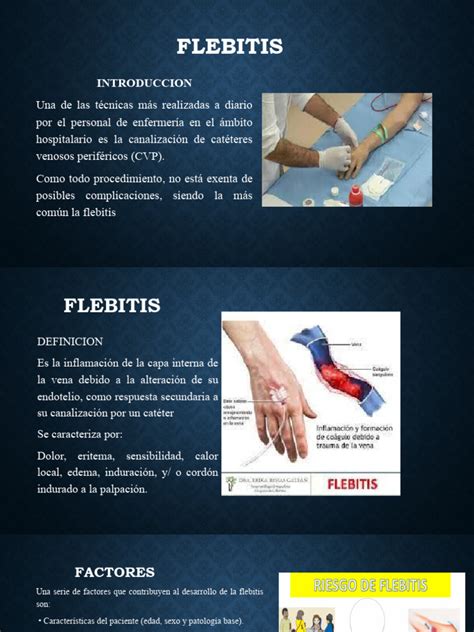 Flebitis Exposicion Pdf Lavado De Manos Especialidades Medicas