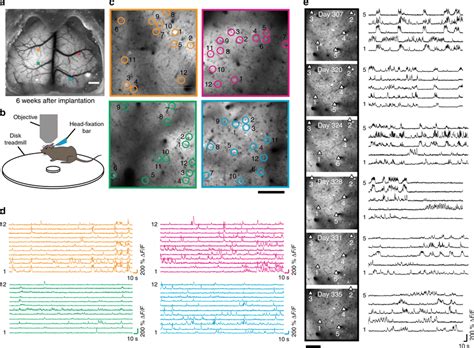 Monitoring Ca²⁺ Activities In Awake Head Fixed Mice A Wide Field Image