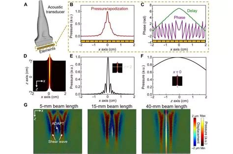 Acoustic Elasticity Imaging Using Adaptive Profile Technology Resistant