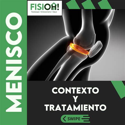 🤓menisco👀 Fisioh