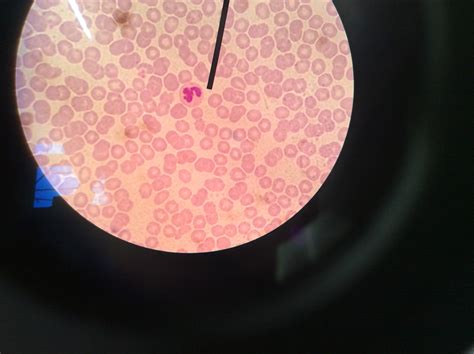 Lpo Wbc Histopath Guide