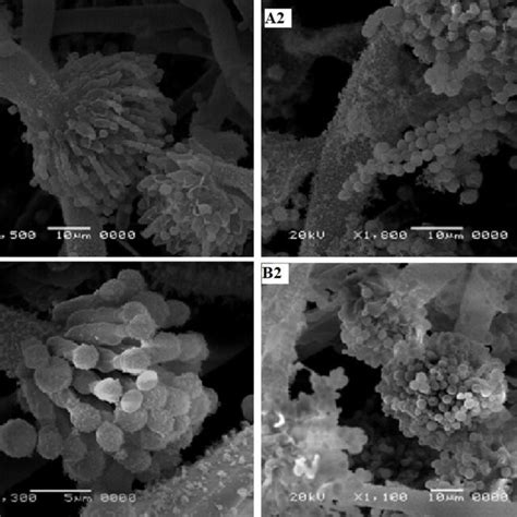 Scanning Electron Microscopy Illustrating The Pattern Of Both A Download Scientific Diagram