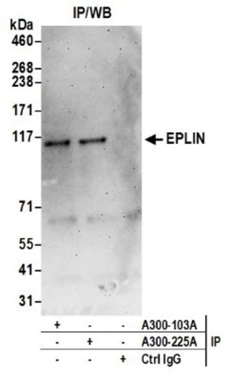 Eplin Antibody 01mg Unlabeledantibodies Polyclonal Fisher Scientific