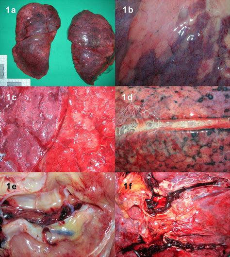 A Heavy Congested Lungs Case 52 B Patchy Pleural Surface With