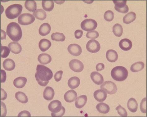 Gambar Sel Eritrosit 50 Koleksi Gambar