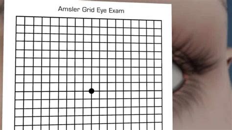 What Is An Amsler Grid Understanding The Eye Test For Macular