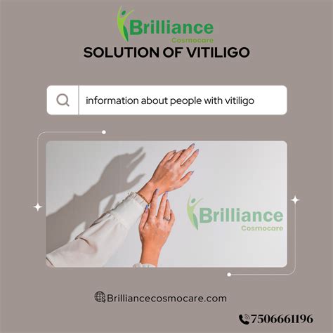 Solution Of Vitiligo Brilliance Cosmocare Medium