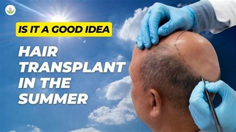 Hair Transplant In The Summer Is It A Good Idea Dr Sandeep Bhasin