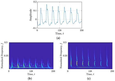 Method For Automatic Estimation Of Instantaneous Frequency And Group Delay In Timefrequency
