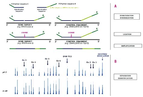 Multiplex Ligation Dependent Probe Amplification Enhances Molecular Diagnosis Of Diamond