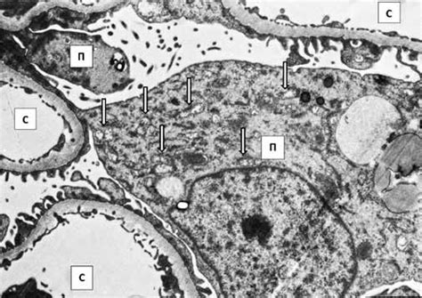 Renal Glomerulus Fragment The Podocyte Cytoplasm Contains Small