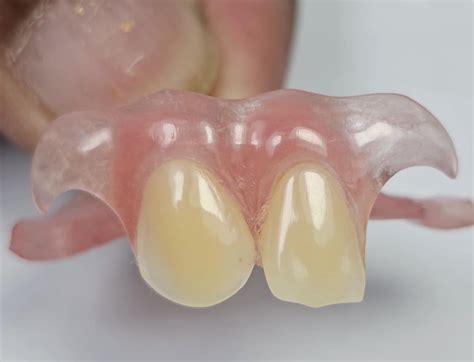 Linux Protesisdental Vicente López