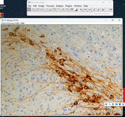 组化片子如何利用image J 进行阳性信号面积占比统计分析 知乎