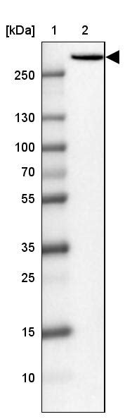 Anti Itpr1 Human Protein Atlas Antibody