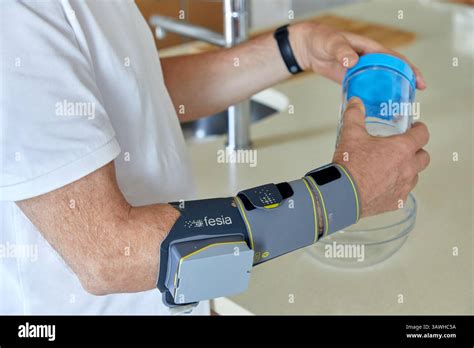 The Rehabilitation Device Based On Functional Electrical Stimulation Fes That Generates