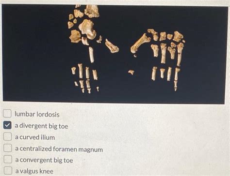 Solved The Argument That The Fossil Remains Of Ardipithecus