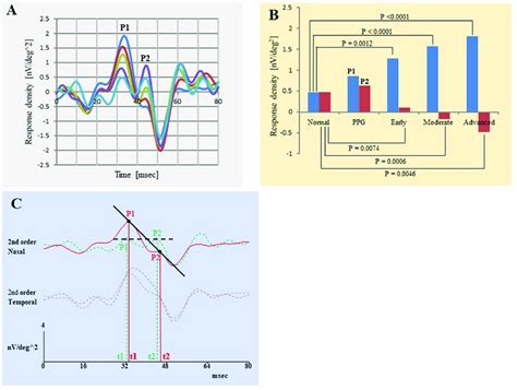 Averaged First Slice Of Second Order Kernel Of The Mfergs Of The Nasal