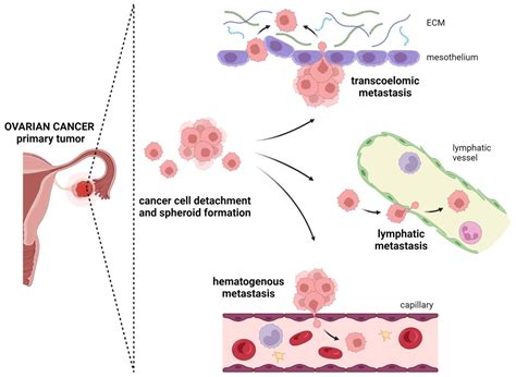A Recipe For Successful Metastasis Transition And Migratory Modes Of