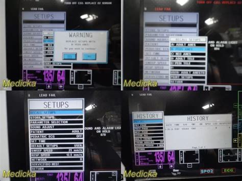 Used Invivo 2015 Philips Expression Co2 Ibp Nbp Ekg Spo2 Agent Gas