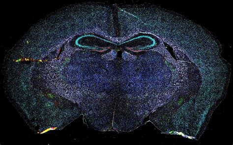 High Speed Four Camera Set Up For Spatial Transcriptomics Analysis Crestoptics
