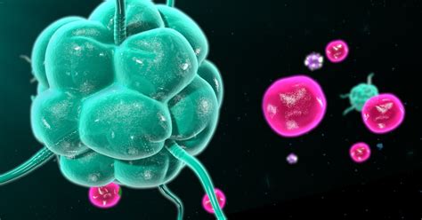 Five Lupus Patients Enter Long Lasting Remission After Immunotherapy