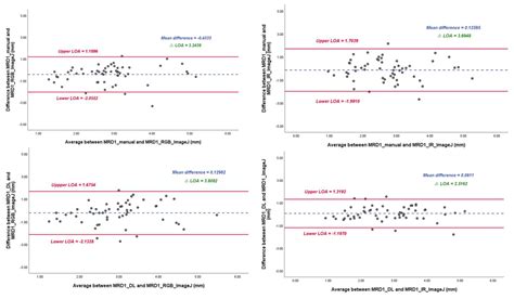 Introduction Of Deep Learning Based Infrared Image Analysis To Marginal