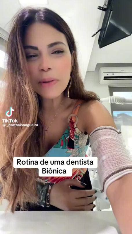 Beautiful Sbe Amputeegirl With Prosthetic Amputee Barbie On Tumblr