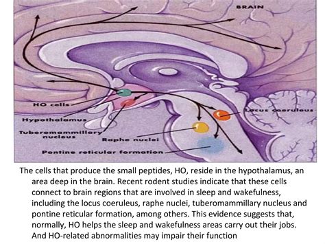 Multiple Sleep Latency Test Mslt And Maintenance Of Wakefulness Test