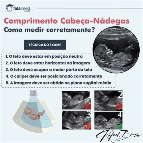Técnica Para Medida Do Comprimento Cabeça Nádegas Ccn