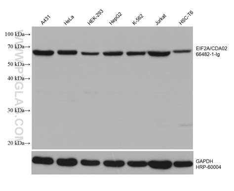 Eif2a Cda02 Antibody 66482 1 Pbs Proteintech