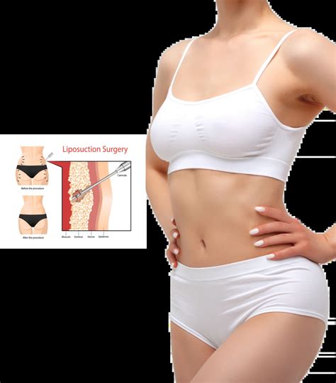 Effective Fat Removal With Liposuction In Hyderabad At Lux