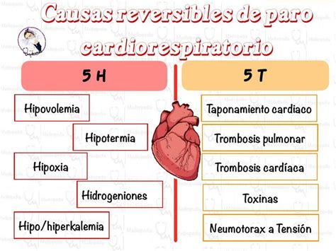 Causas Reversibles De Paro Medicipedia Udocz