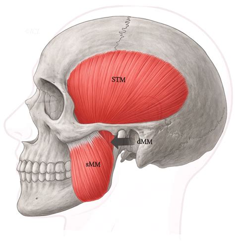 The Deep Head Of The Masseter Muscle A Classification Based Anatomical