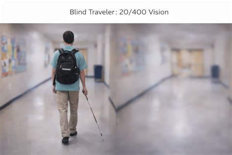 What Does 20400 Vision Look Like Dr Denise M Robinson