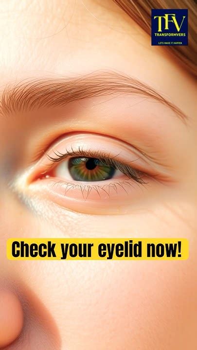 “look At Your Eyelids 👁️ What Pale Or Puffy Eyes Could Mean For Your