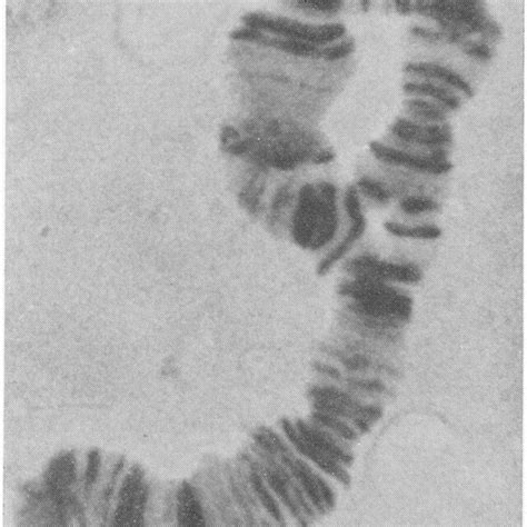 Polytene Element 7 Of D Pachea In The Heterozygous 7 A