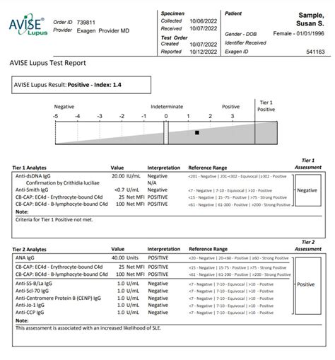 Avise Lupus Advanced Testing For Lupus Diagnosis