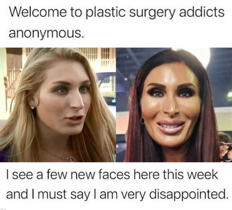 Plastic Surgery Wife Memes