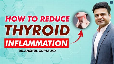 Reducing Thyroid Inflammation Causessymptoms And Effective Solutions