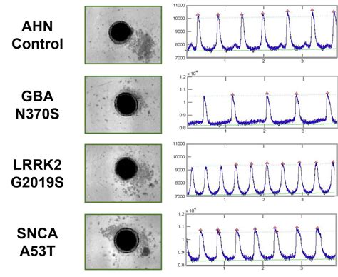 Parkinsons Disease Models Fujifilm Cellular Dynamics Inc