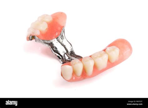 Clasp Prosthesis With Lock Fixation Isolated On White Background Macro