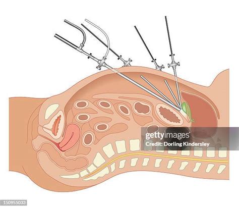 Cross Section Of The Gallbladder Photos And Premium High Res Pictures Getty Images