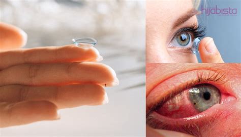 Hijabi Ini Serik Pakai Contact Lens Kornea Mata Luka Akibat Beli Di
